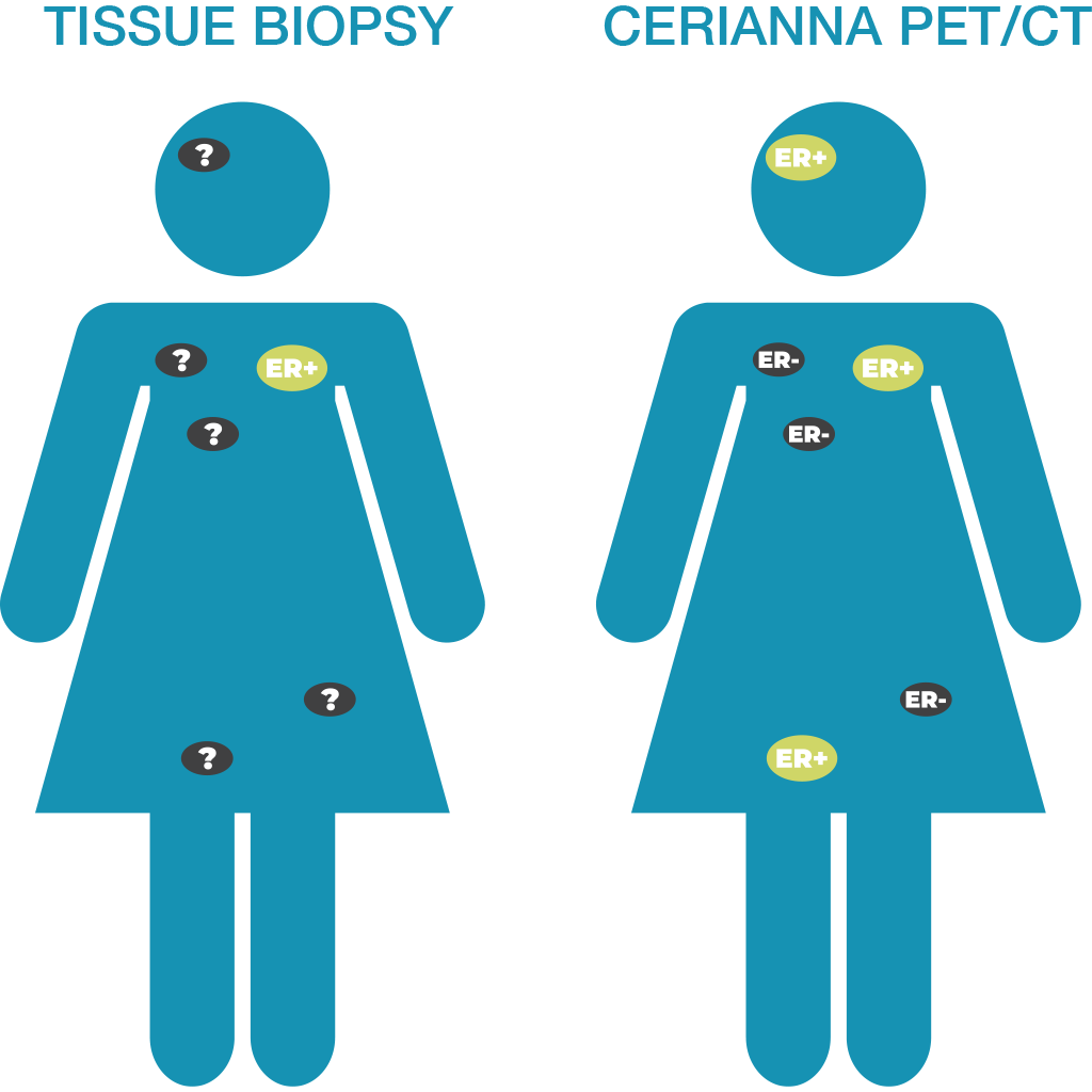 Cerianna PET/CT - Imaging Healthcare Specialists